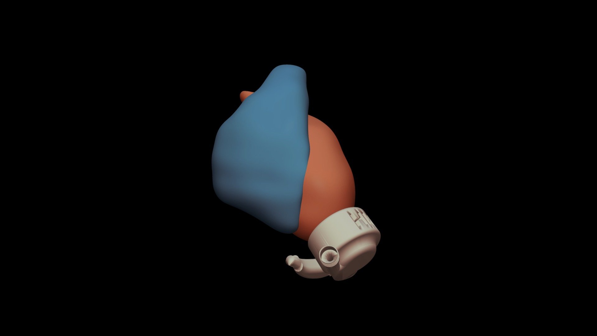 HU-CVC:20:007 (overview) - 3D model by Imre J. Barabás, MD, M.Sc ...