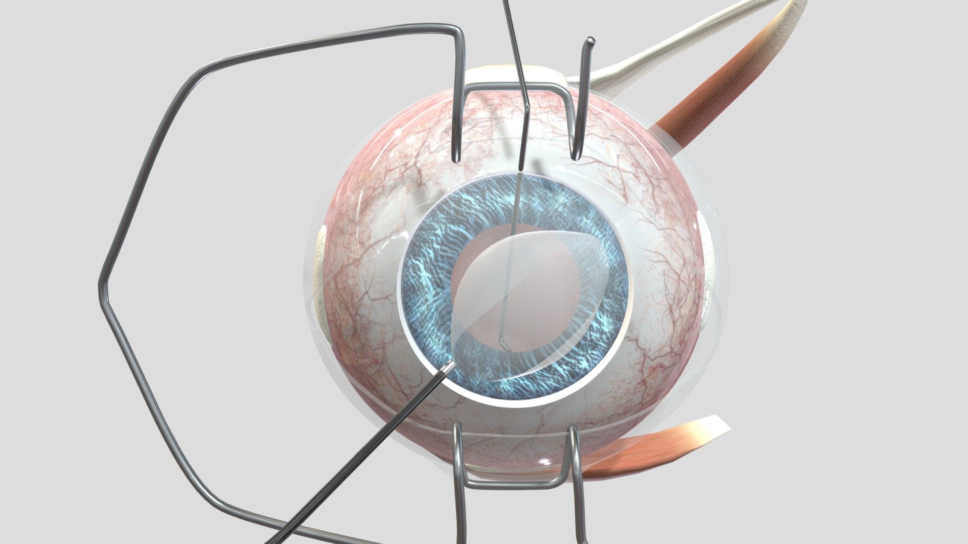 DMEK - Step 1 - 3D model by Holoxica [c0cf53a] - Sketchfab