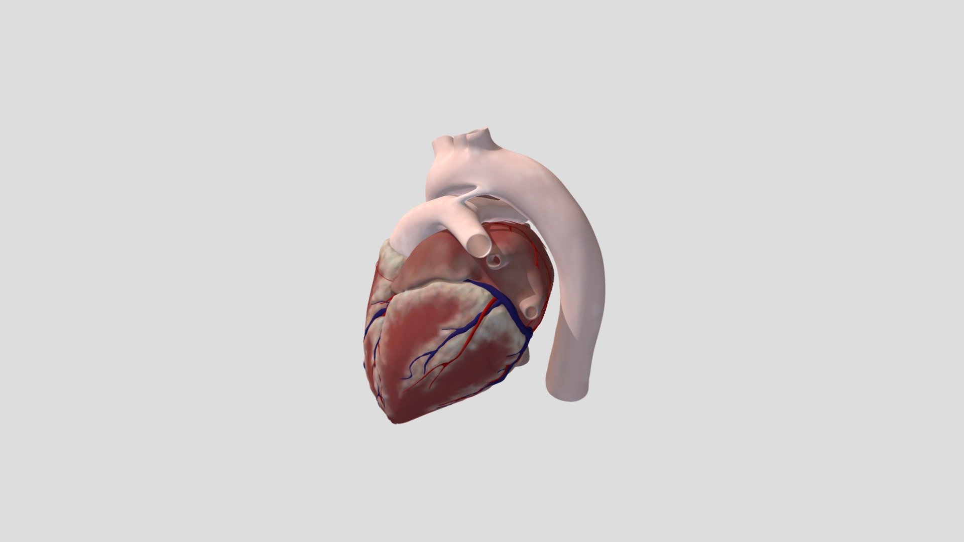 Atrioventricular Septal Defect - Download Free 3D model by ...