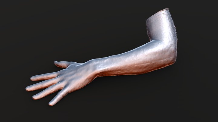 Orthopedic 3D models - Sketchfab