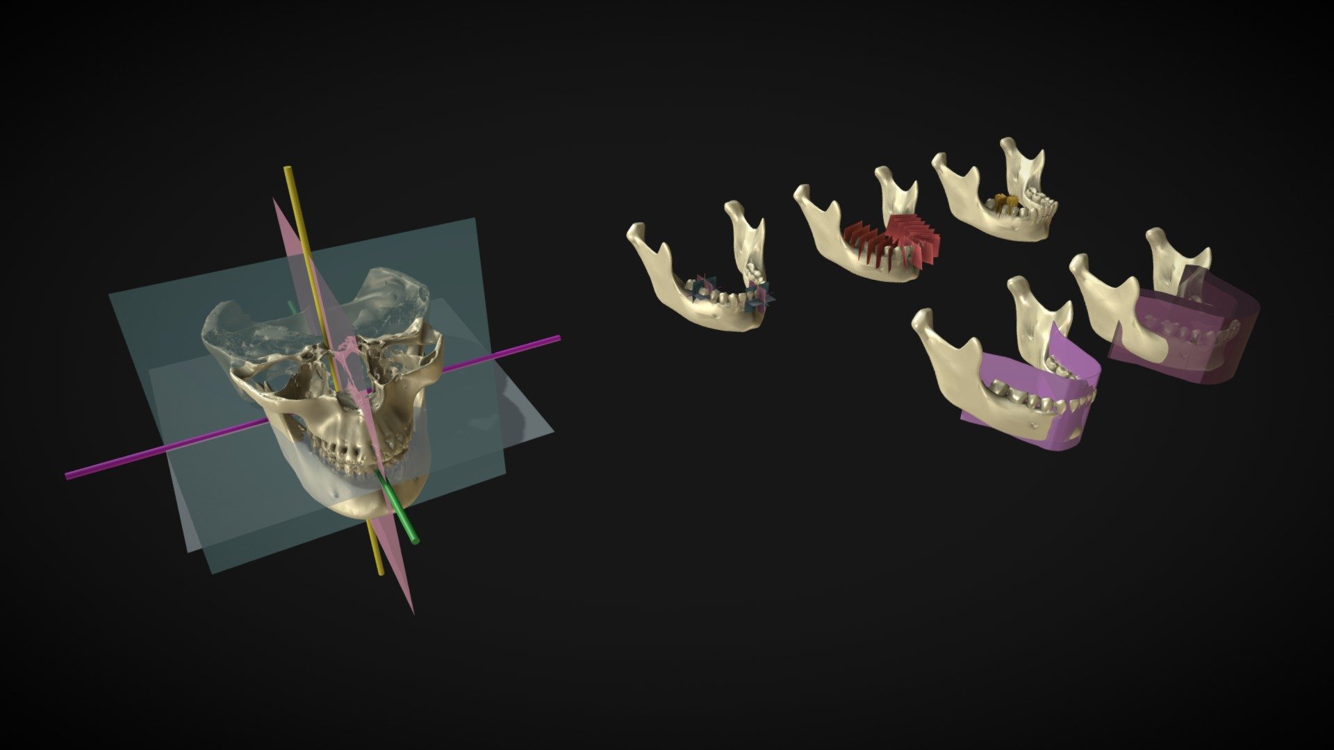 Multiplanar Reconstruction (MPR) - 3D model by Muhammad Nabeel ...