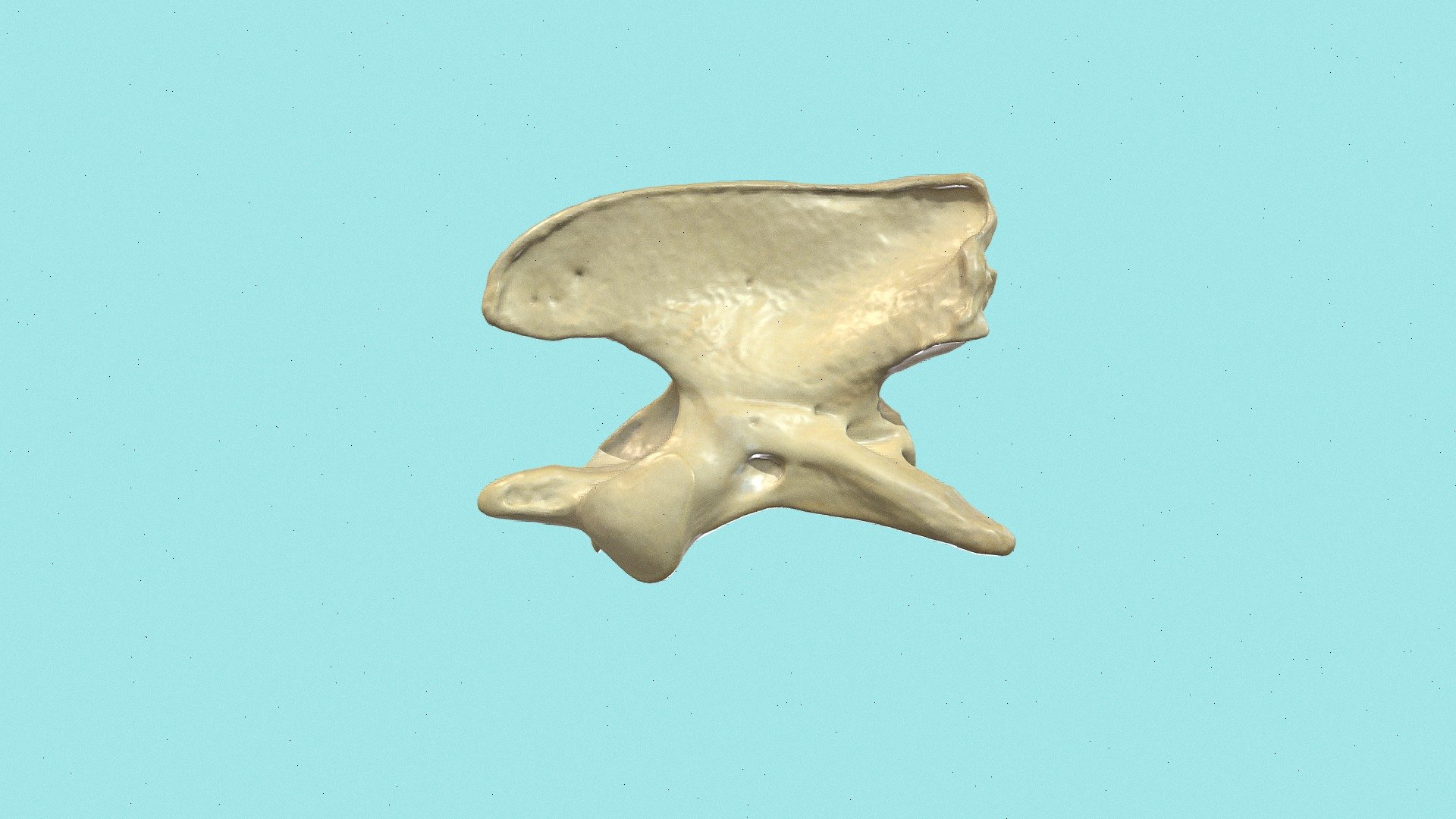 Axis Hund - beschriftet - 3D model by FU Berlin Veterinary Anatomy ...