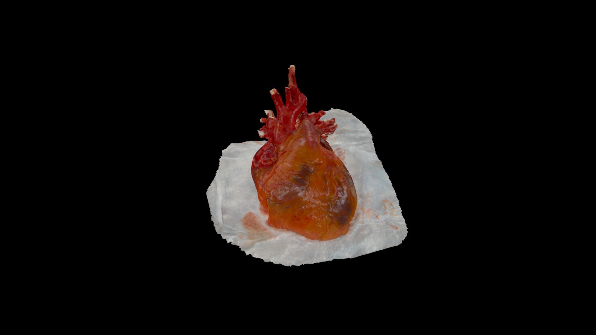 Cadaver Dissection Step 6: Heart Anterior - 3D model by ...