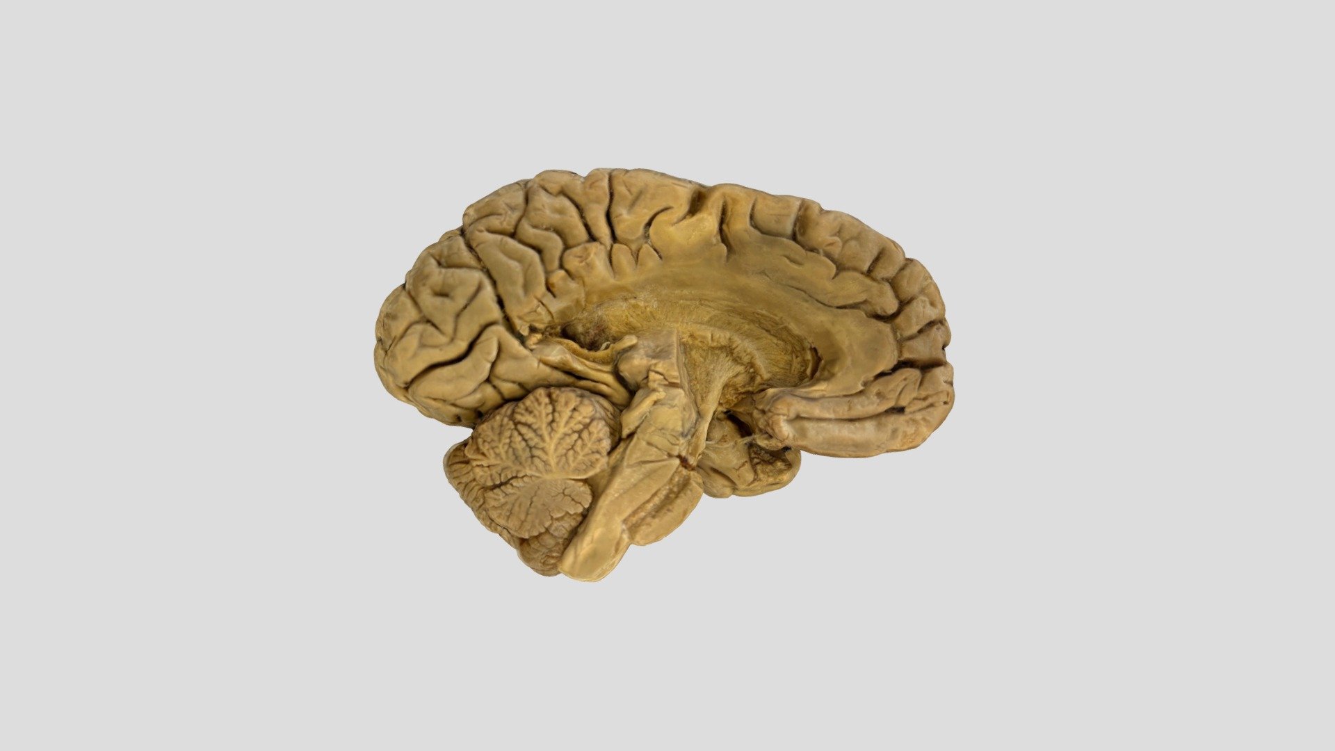 Hemi-sected brain - 3D model by msdlt [c28ec98] - Sketchfab