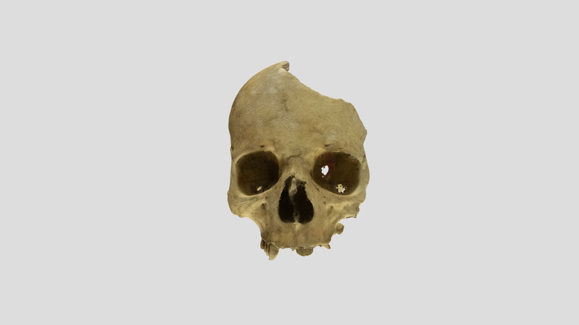 Atlas - Axis - Skull 15 - 3D model by Salvatore Ficarra (@salvatore ...