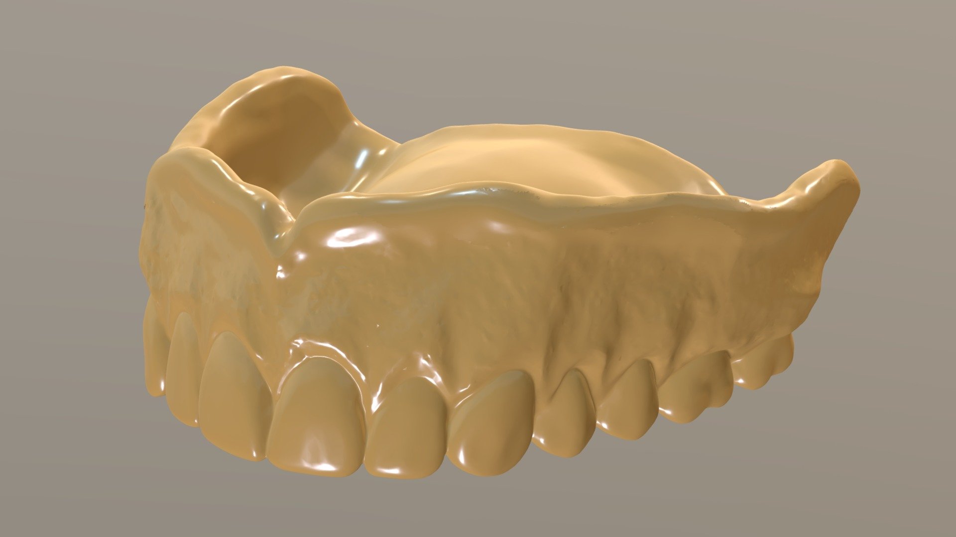 Maxillary Complete Denture - Ernie Wolfe, CDT - 3D model by ramiammoun ...