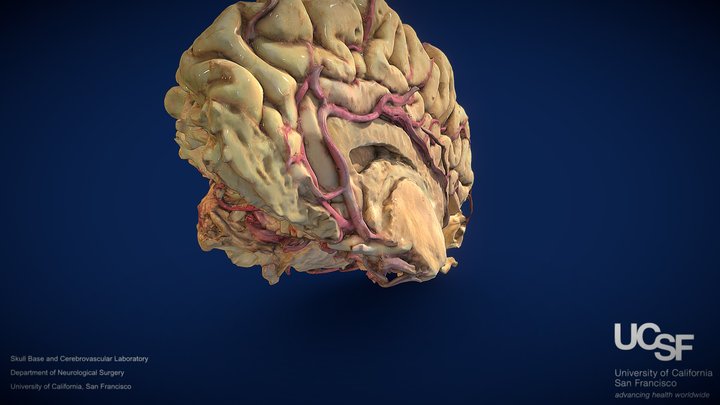 White-matter 3D models - Sketchfab