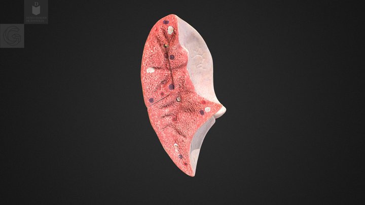 Lungs 3D models - Sketchfab