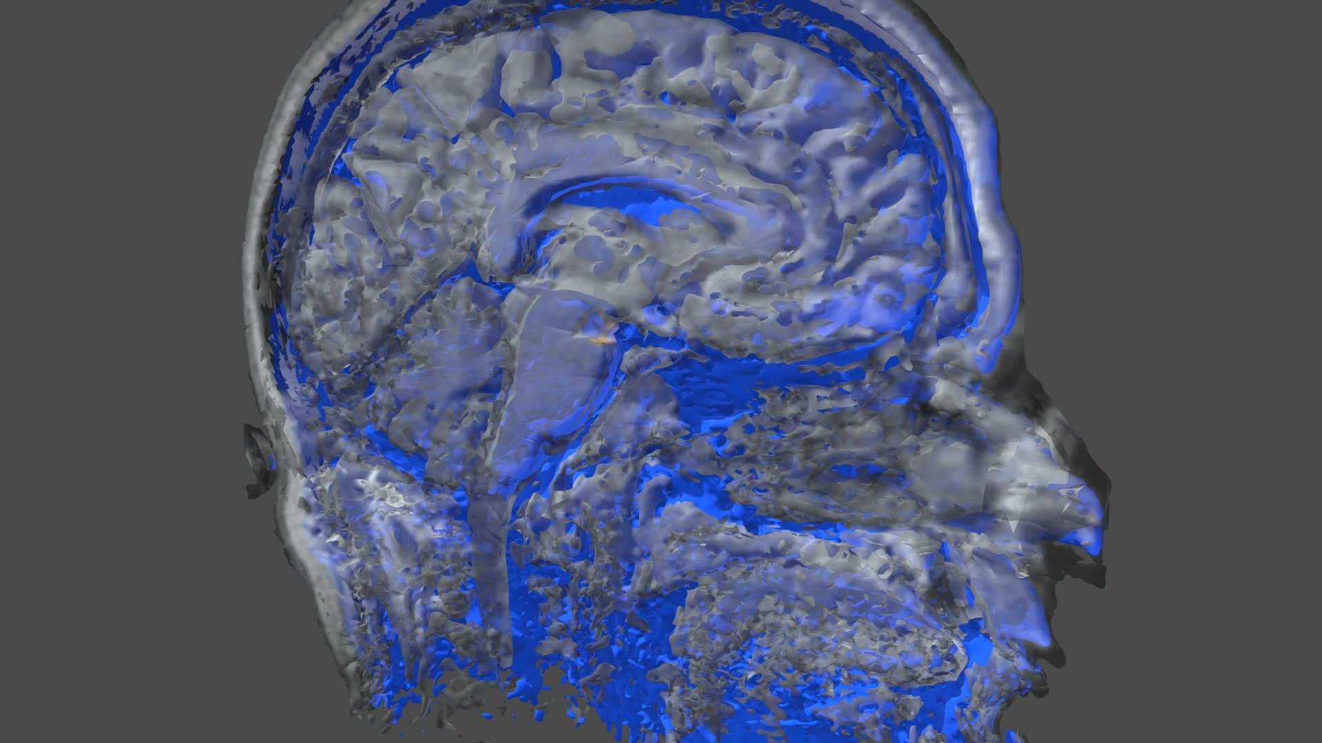 CT SCAN DATA - BRAIN - 3D model by Something [c3d6a8f] - Sketchfab