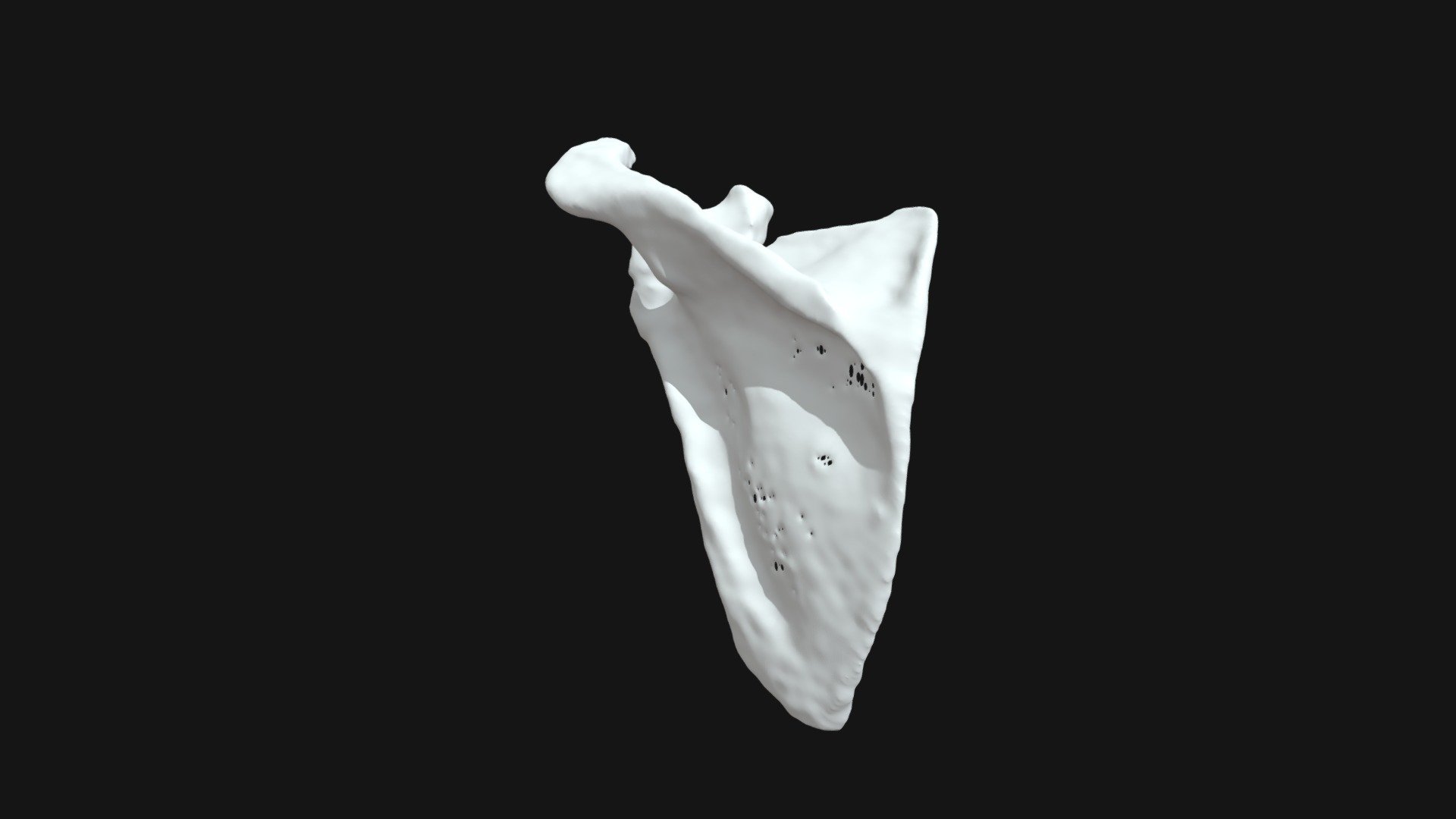 Left Scapula Reconstruction - Download Free 3D model by Umesh Persad ...