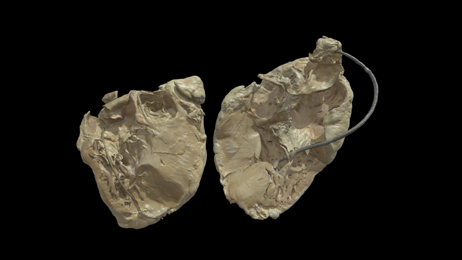 Plastinated Human Heart with Pacing Leads #0032 - Download Free 3D ...