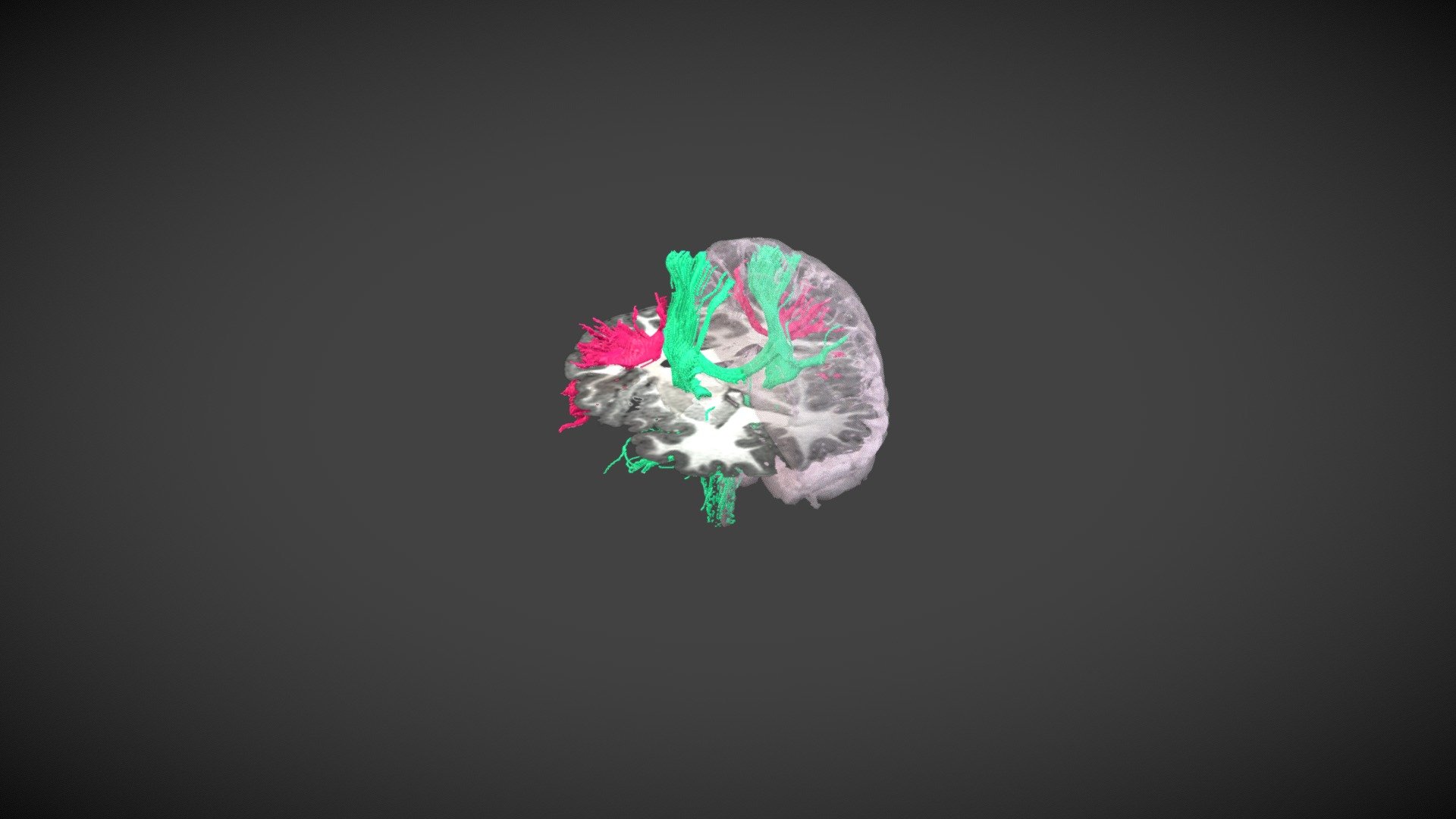 DTI test 2 - 3D model by Lincoln Wong (@lincolnwong) [c481e2e] - Sketchfab