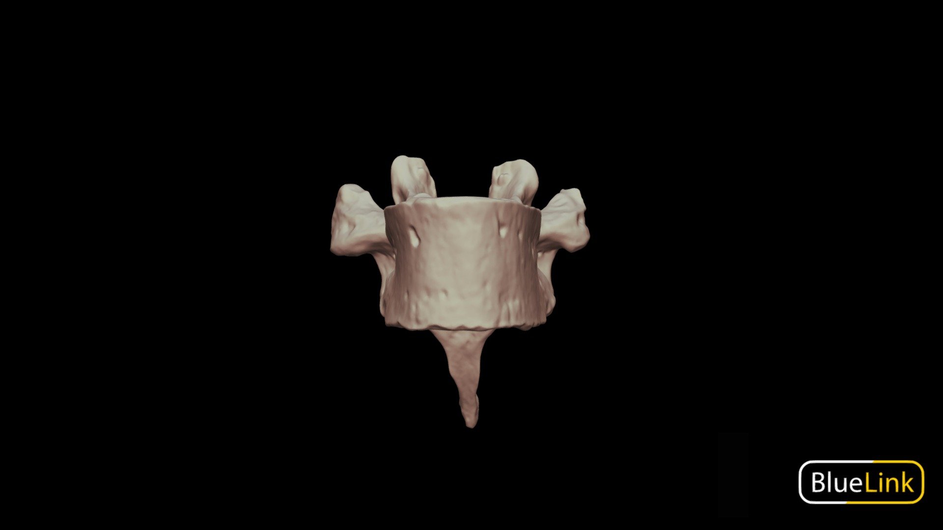Thoracic Vertebrae - T6, Labeled - 3D model by Bluelink Anatomy ...