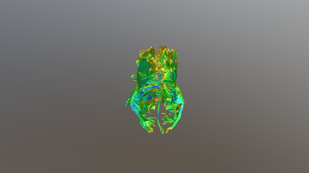 Brain DTI fibers - 3D model by Ali Panahi (@panaali) [c5ca238] - Sketchfab