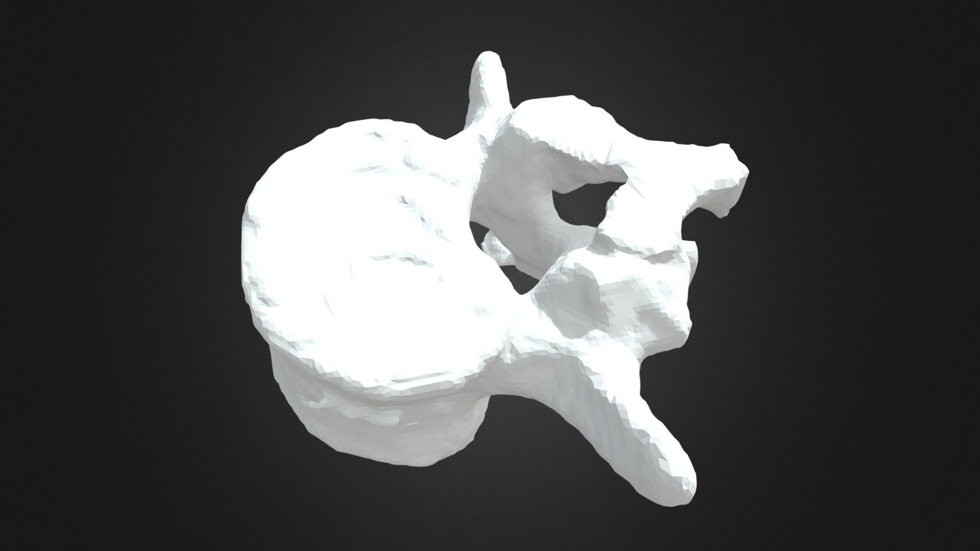 CT SCAN DATA - Vertebrae - 3D model by AXO Studio [c5e7fed] - Sketchfab