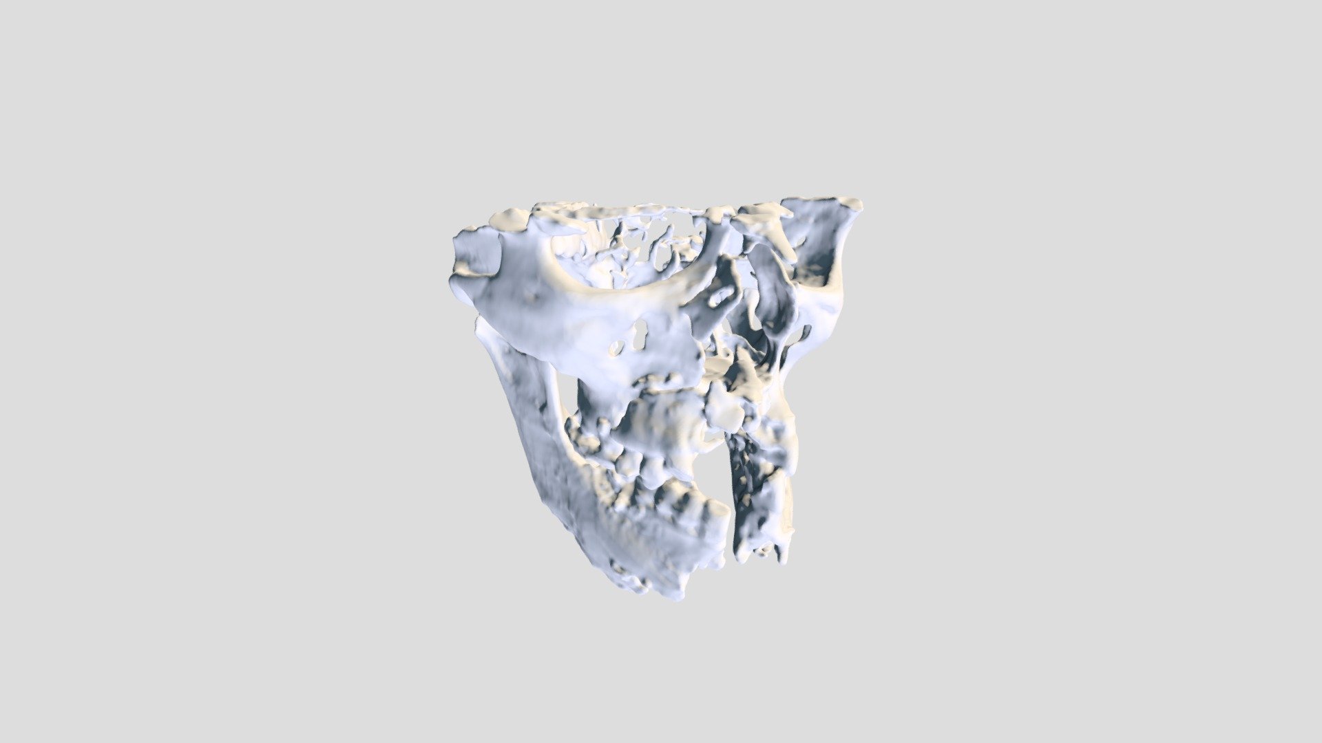 Gunshot Wound To Face - 3D model by tomomahoney [c61960a] - Sketchfab