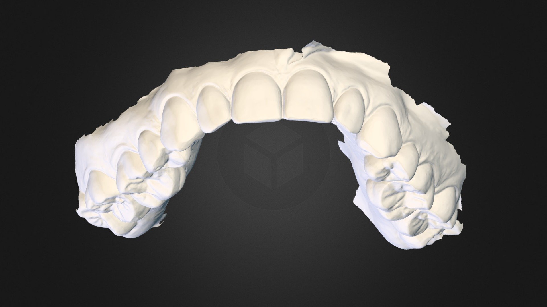 Upper Jaw Scan - 3D model by promarketing [c64887f] - Sketchfab