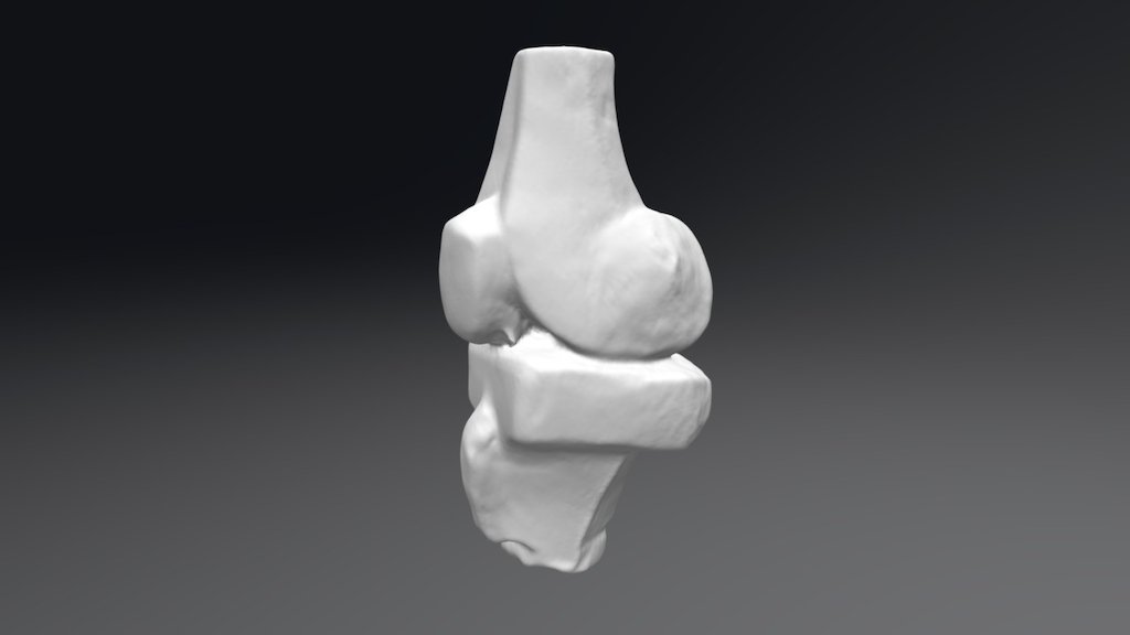 Simplified model of knees - 3D model by threeding.com [c6b94e8] - Sketchfab