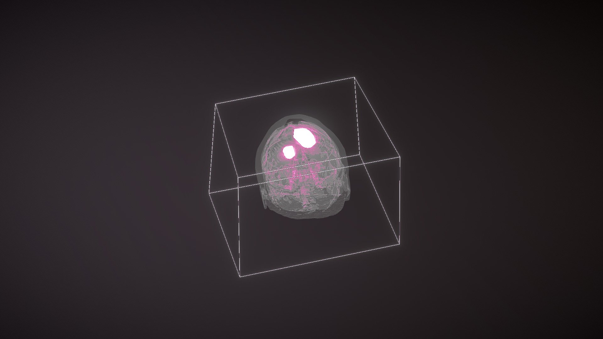 Skin Mri Tm - 3D model by ihsandoganmd [c6c260b] - Sketchfab