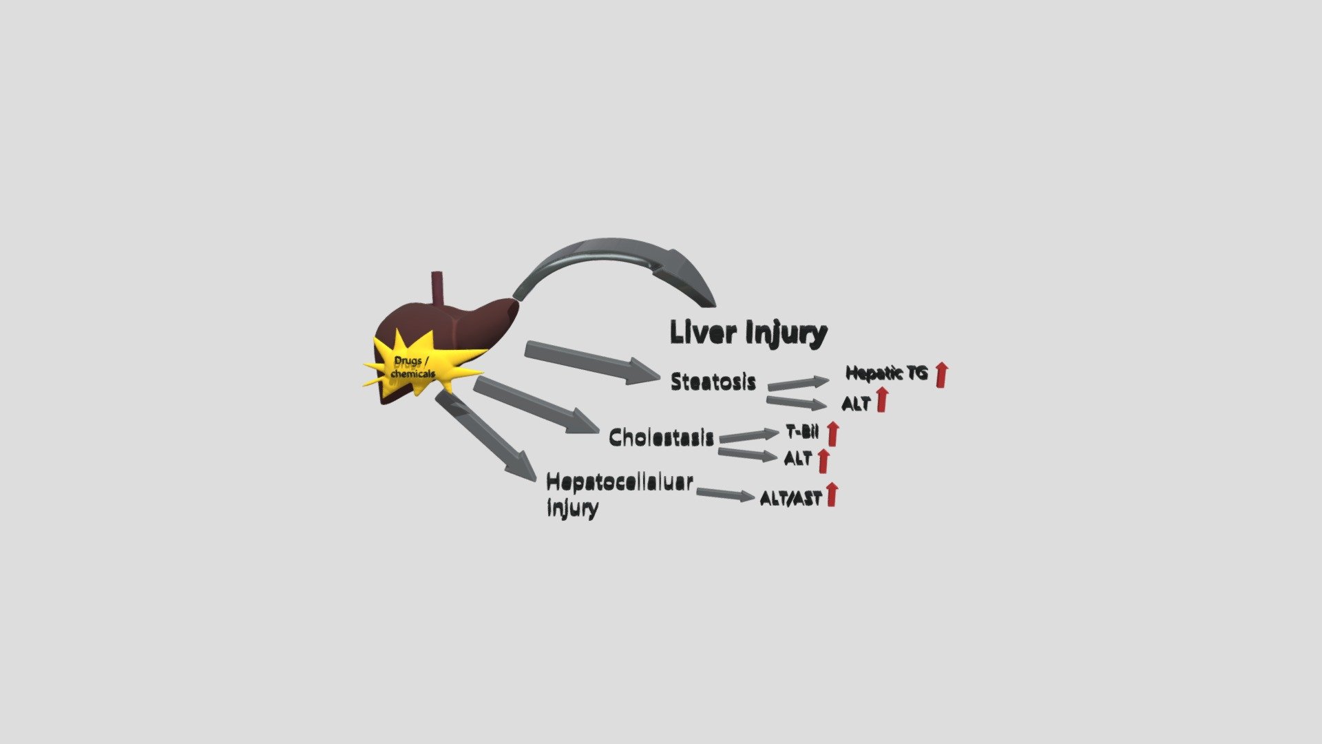 Liver Injury - 3D model by ameer669 [c743c9e] - Sketchfab