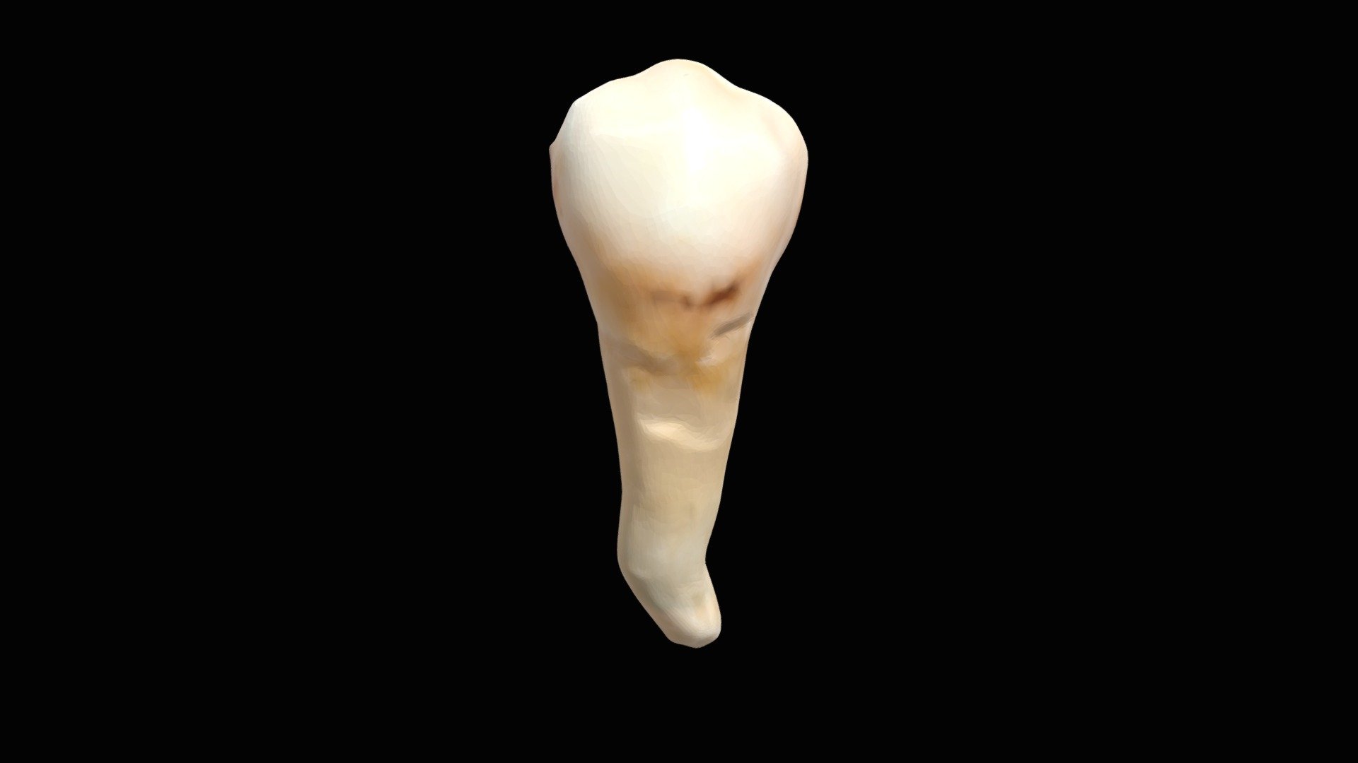 Segundo premolar mandibular izquierdo (3.5) - 3D model by GIDPTD ...