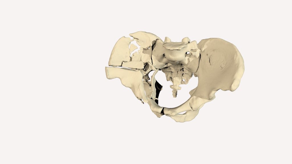 Anatomy and Cadaver Scans - A 3D model collection by madgiraffe - Sketchfab
