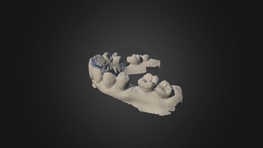 Dental Sample1 - 3D model by elearning2 [c7f239d] - Sketchfab