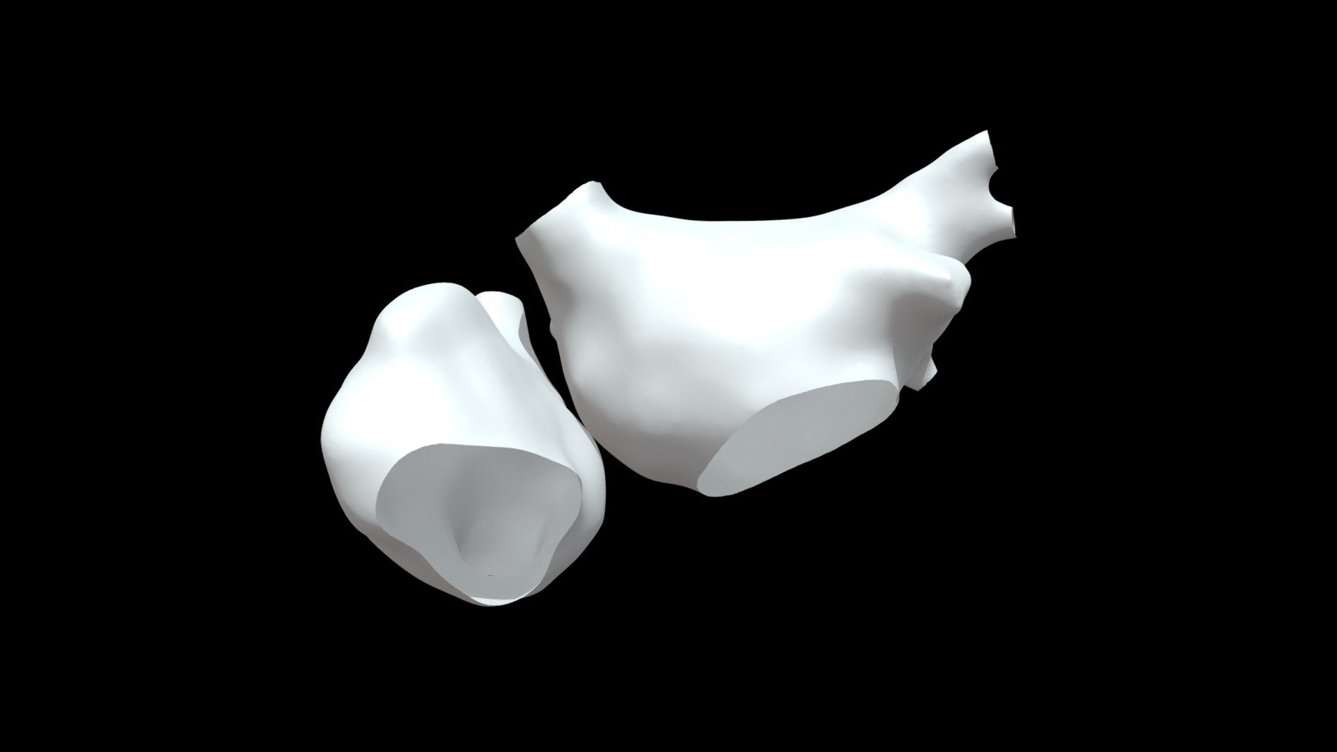 Atrial geo - opaque - annotated - 3D model by drj (@drjameswinter ...