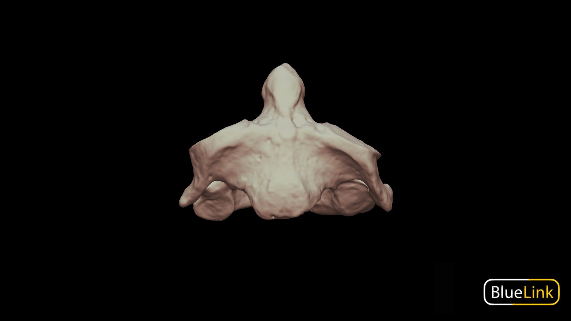 Cervical Vertebrae - C2, Axis, Labeled - 3D model by Bluelink Anatomy ...