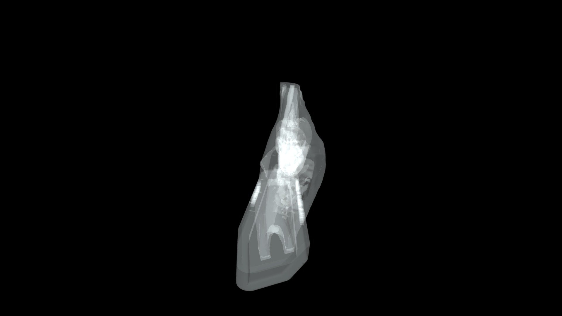 Horizontal Third Molar - 3D model by biomed3d [c8a90c5] - Sketchfab