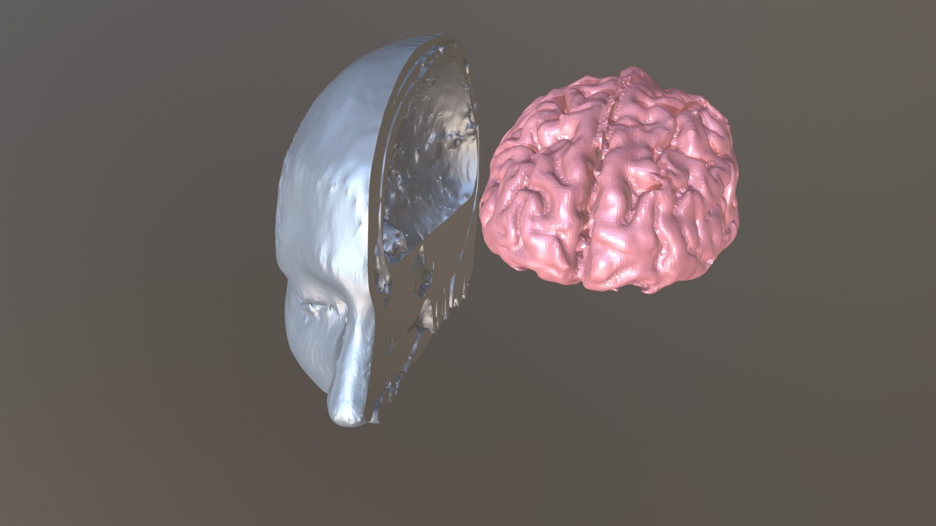 Brain Model Test, CT Scan - 3D model by CHEI - UC San Diego (@chei_ucsd ...