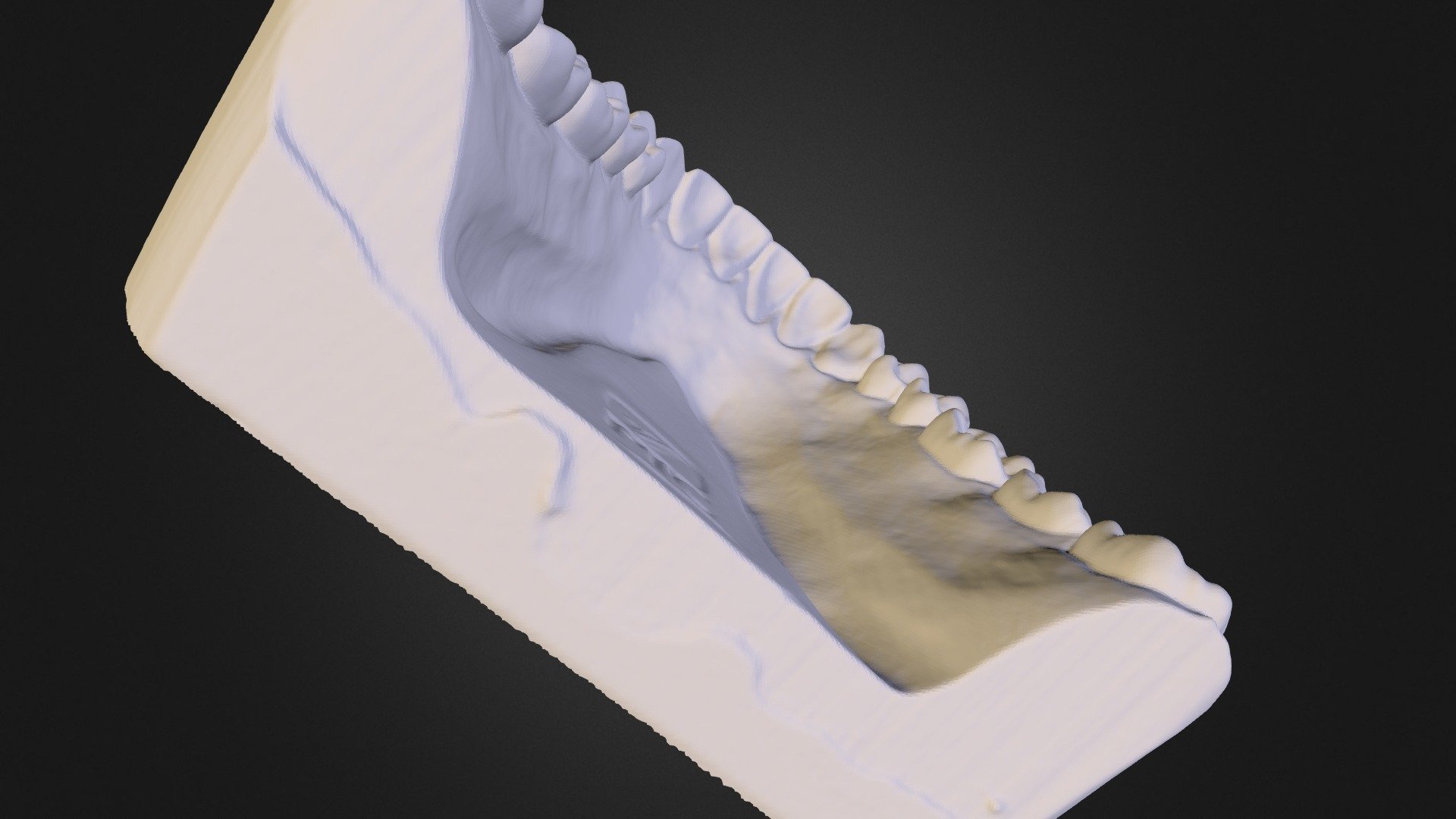 dental-5mp - 3D model by Steven Lichti (@slichti) [c8d4c1e] - Sketchfab