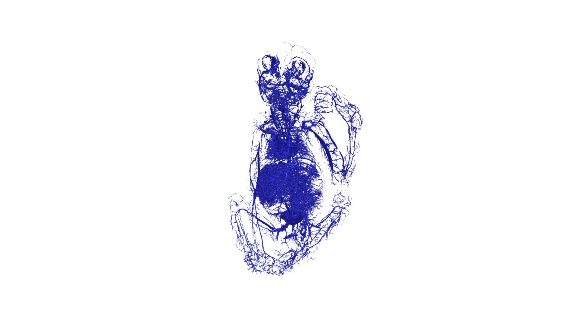 Siamang_Cardiovascular_RSCOM-OH-W098_VAP - Download Free 3D model by ...