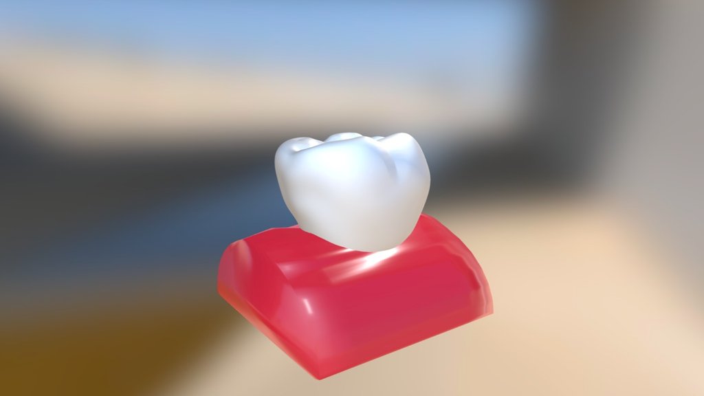 3D Crown Preparation Animation Zirconia - 3D model by Dr Kevin Ho ...