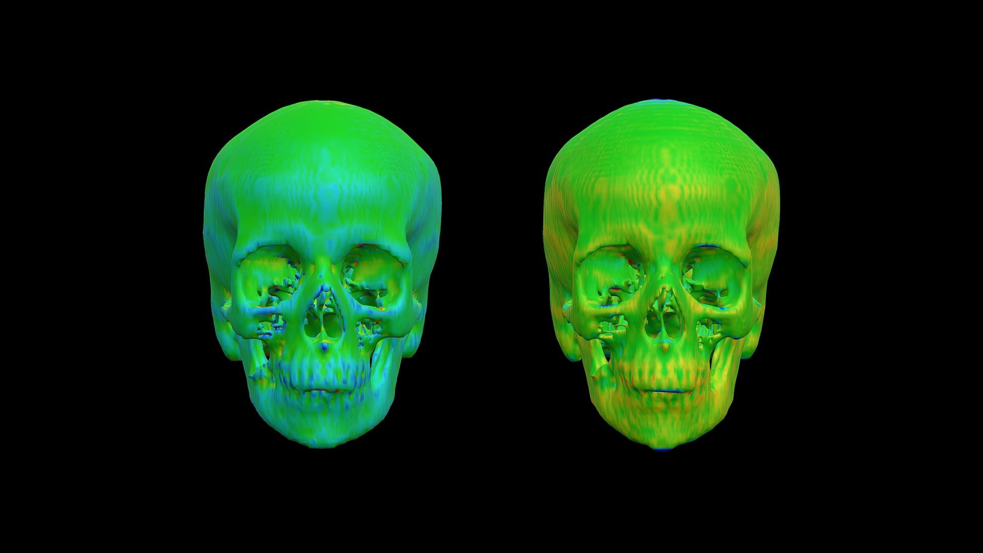Surface to Surface Comparison - 3D model by Terrie Simmons-Ehrhardt ...
