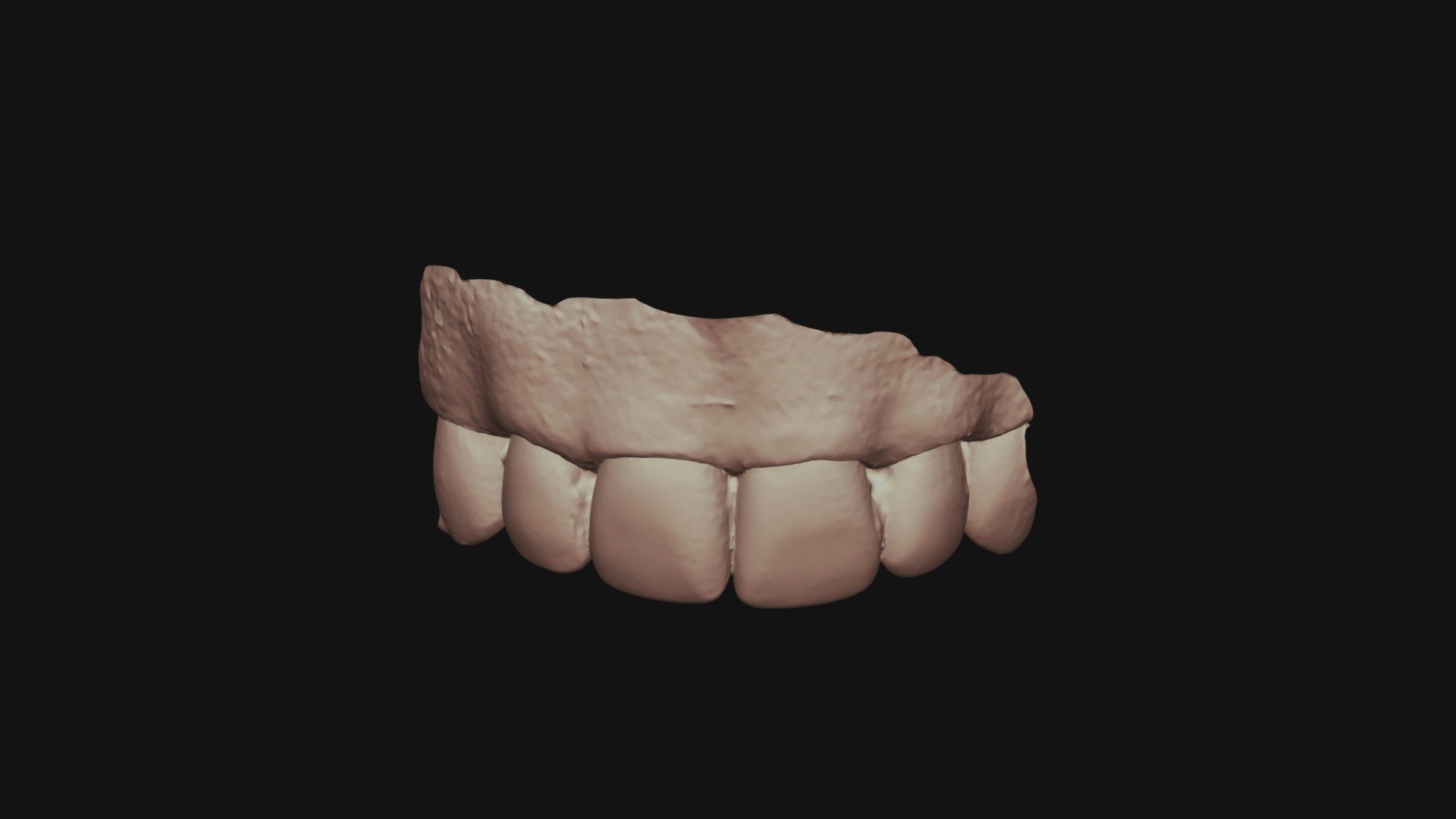 G13tooth#9class3prep2 Upper Jaw - Download Free 3D model by UMdental ...