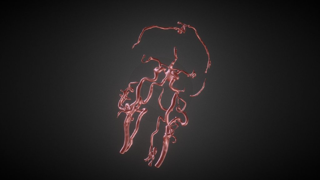 Exam 3 - Question 5 - 3D model by dszuster [cb5cc40] - Sketchfab