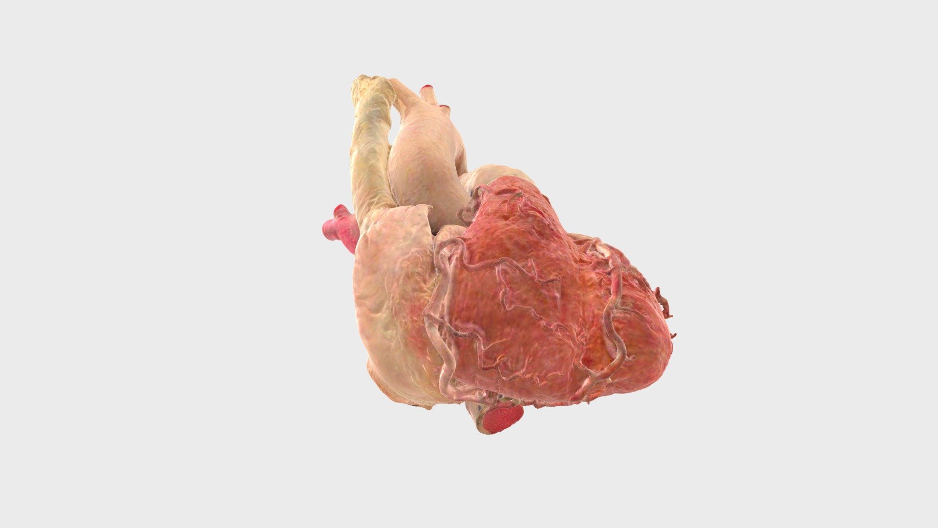 3D Digital Model of Coronary Arteries - 3D model by jeslynpoo [cb63e77 ...