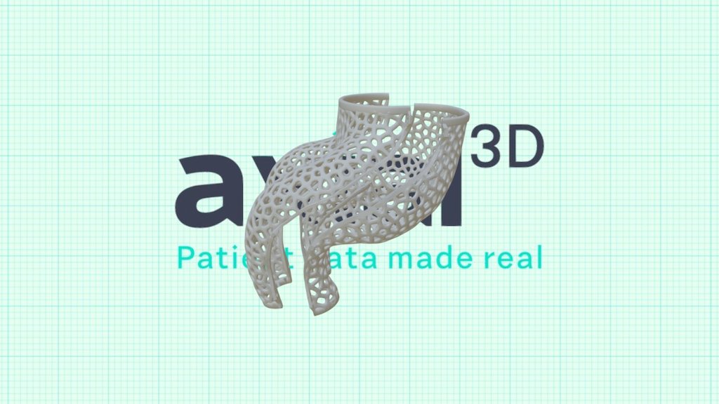 Leg Splint Concept - 3D model by Axial3D [cb90426] - Sketchfab
