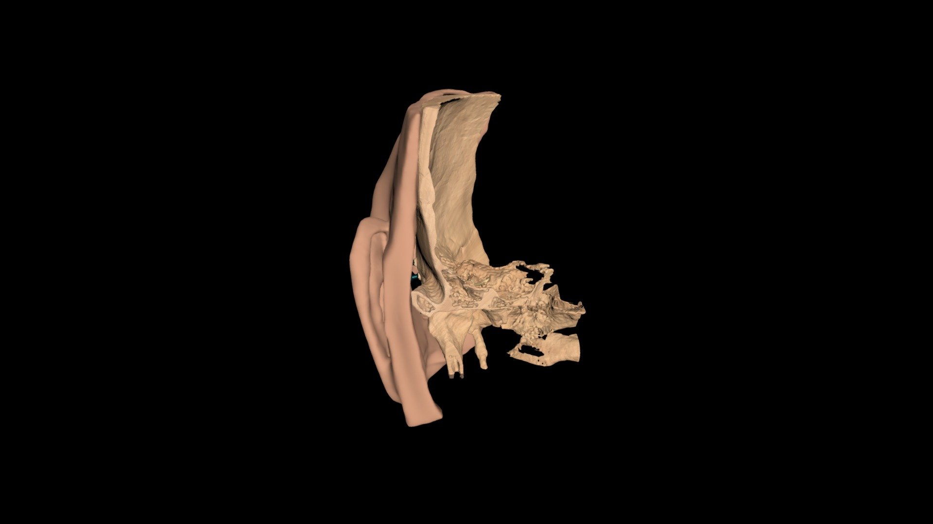 Skin flap test - 3D model by 91daniel.schneider [cbcfec6] - Sketchfab