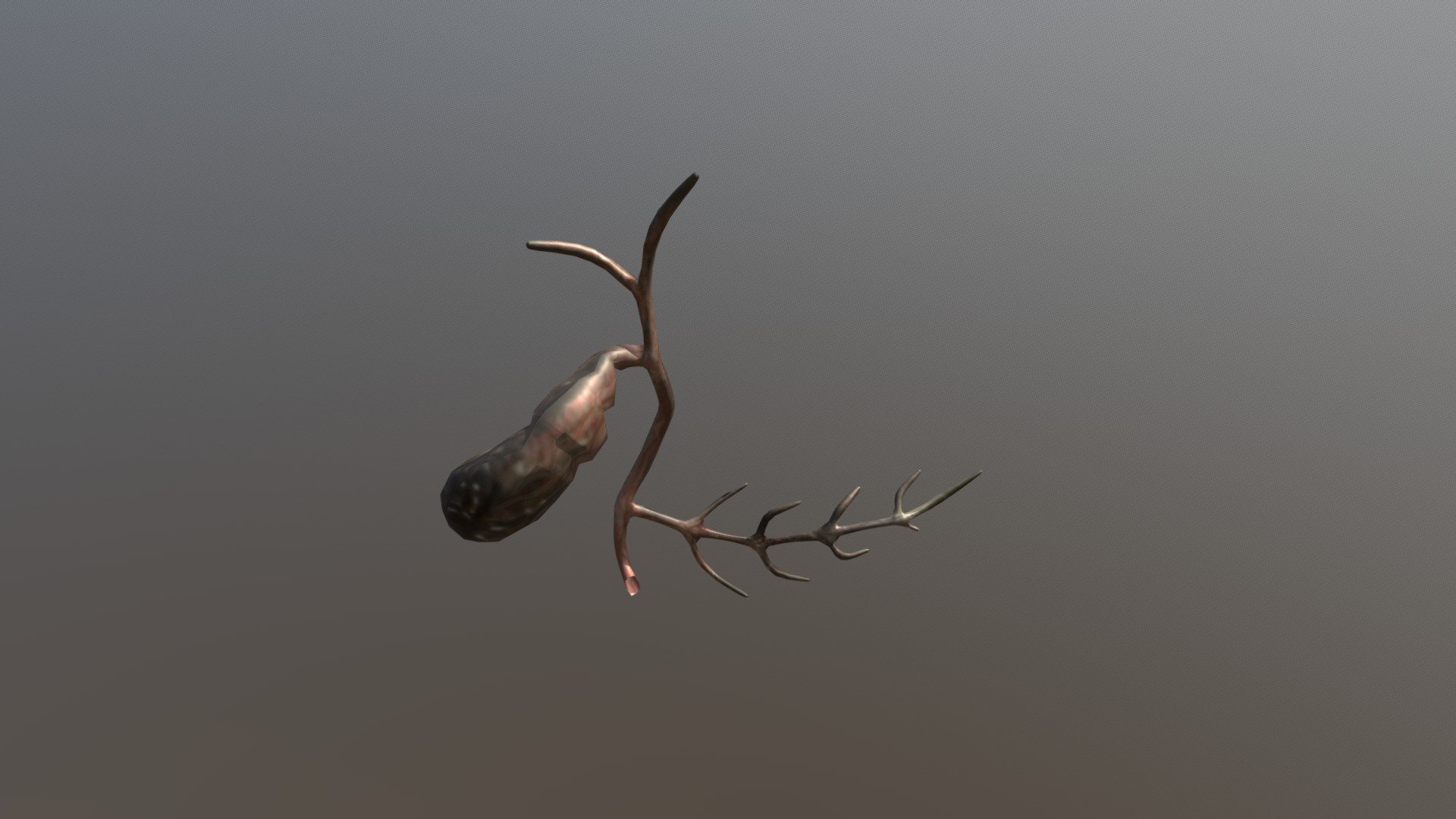 Gallbladder - 3D model by Virtual Reality (@simulanis) [cc105a0 ...