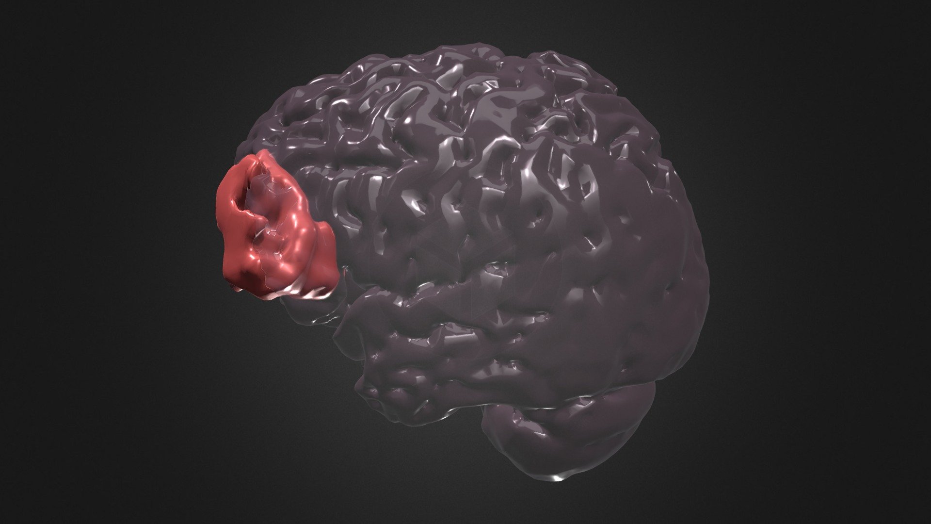 Injured brain basics - 3D model by Tracy A (@tabildskov) [cc36d93 ...