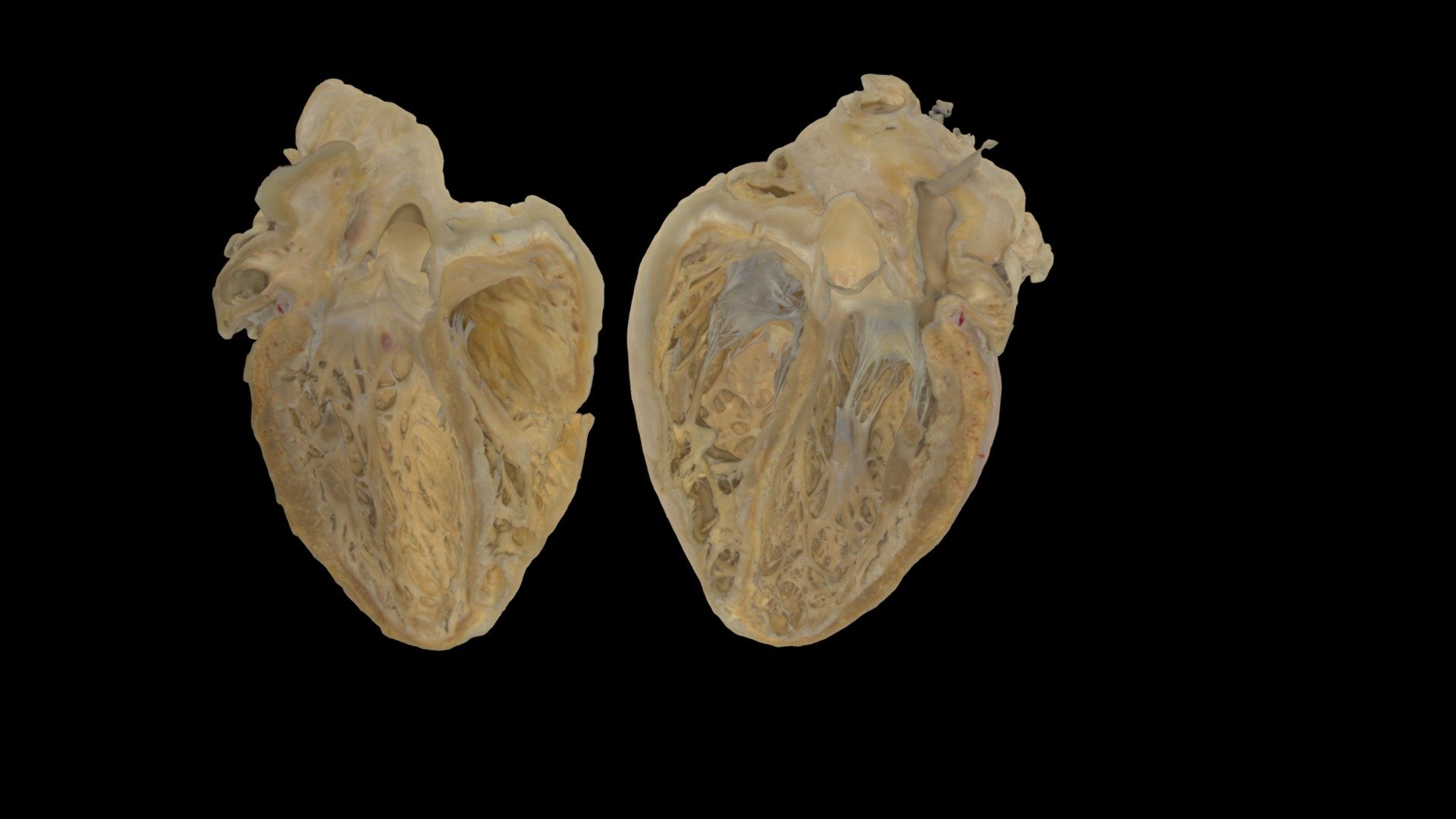 Human Heart Anatomical Cross Section #0111 - Download Free 3D model by ...