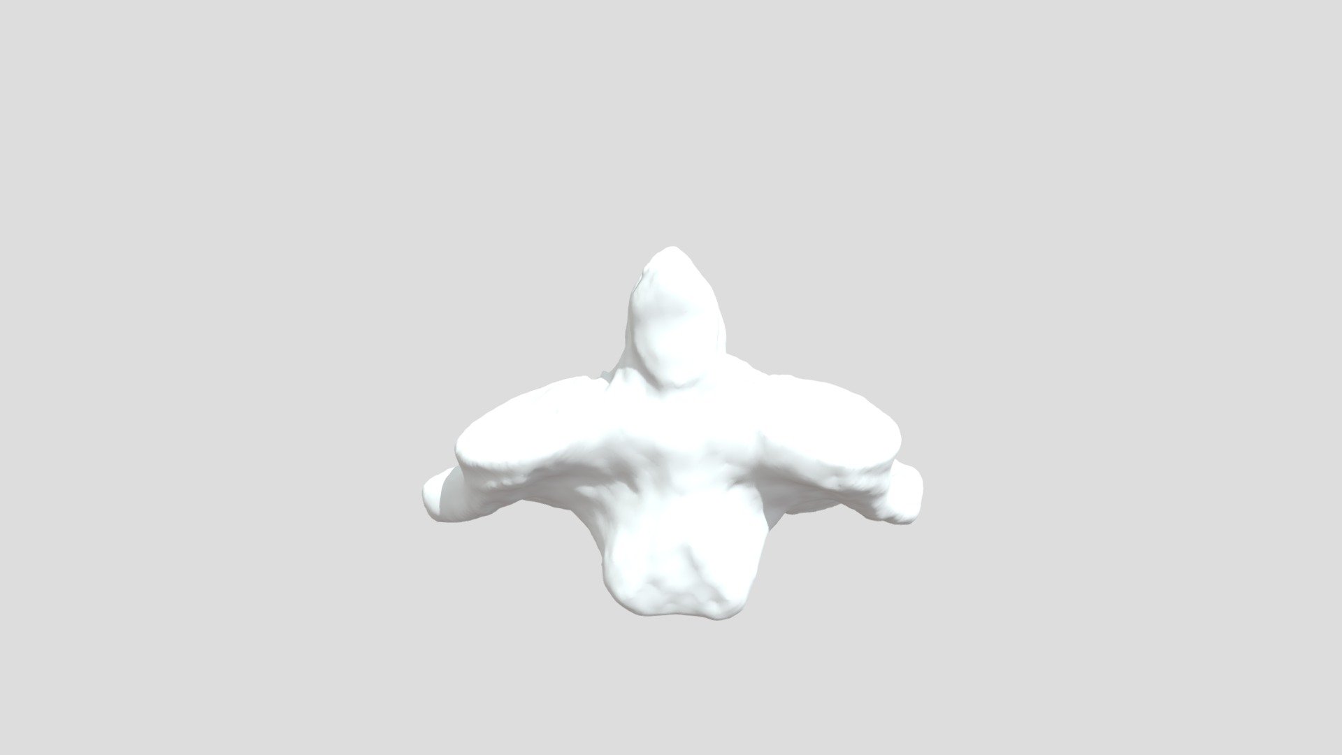 C2 - cervical vertebra - 3D model by Neurosurgeon (@dralex) [cd2bbf5 ...