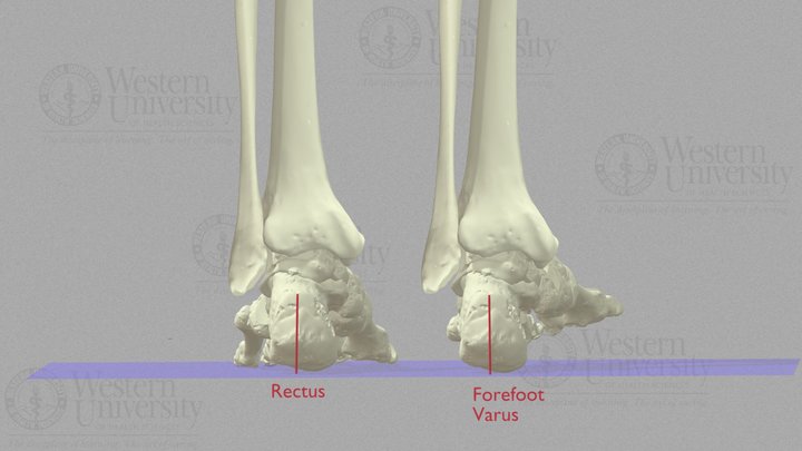 Calcaneus 3D models - Sketchfab