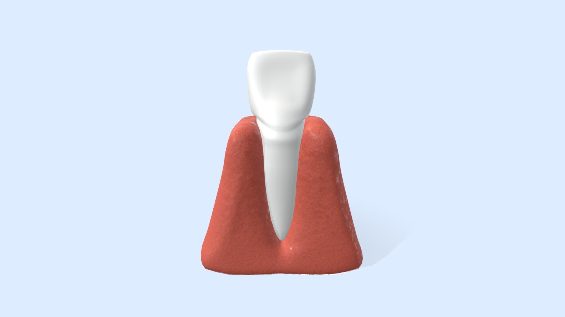 Évolution de la gingivite / Gingivitis - 3D model by Theodagan [cdc6798 ...