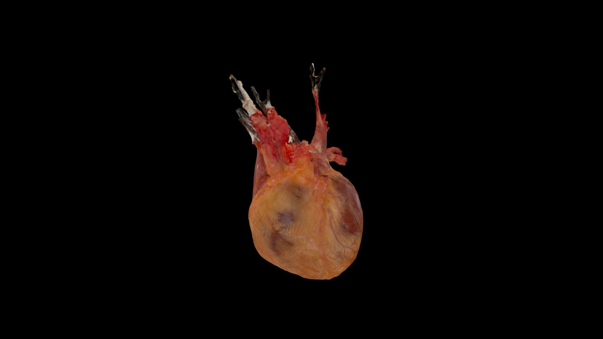 Fresh Human Heart Donation #624 - Download Free 3D model by ...
