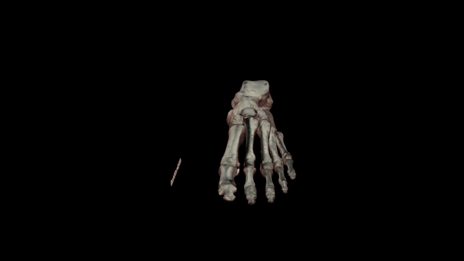 Foot Windlass - 3D model by drdanielhowell (@barefootprof) [cde97a4 ...