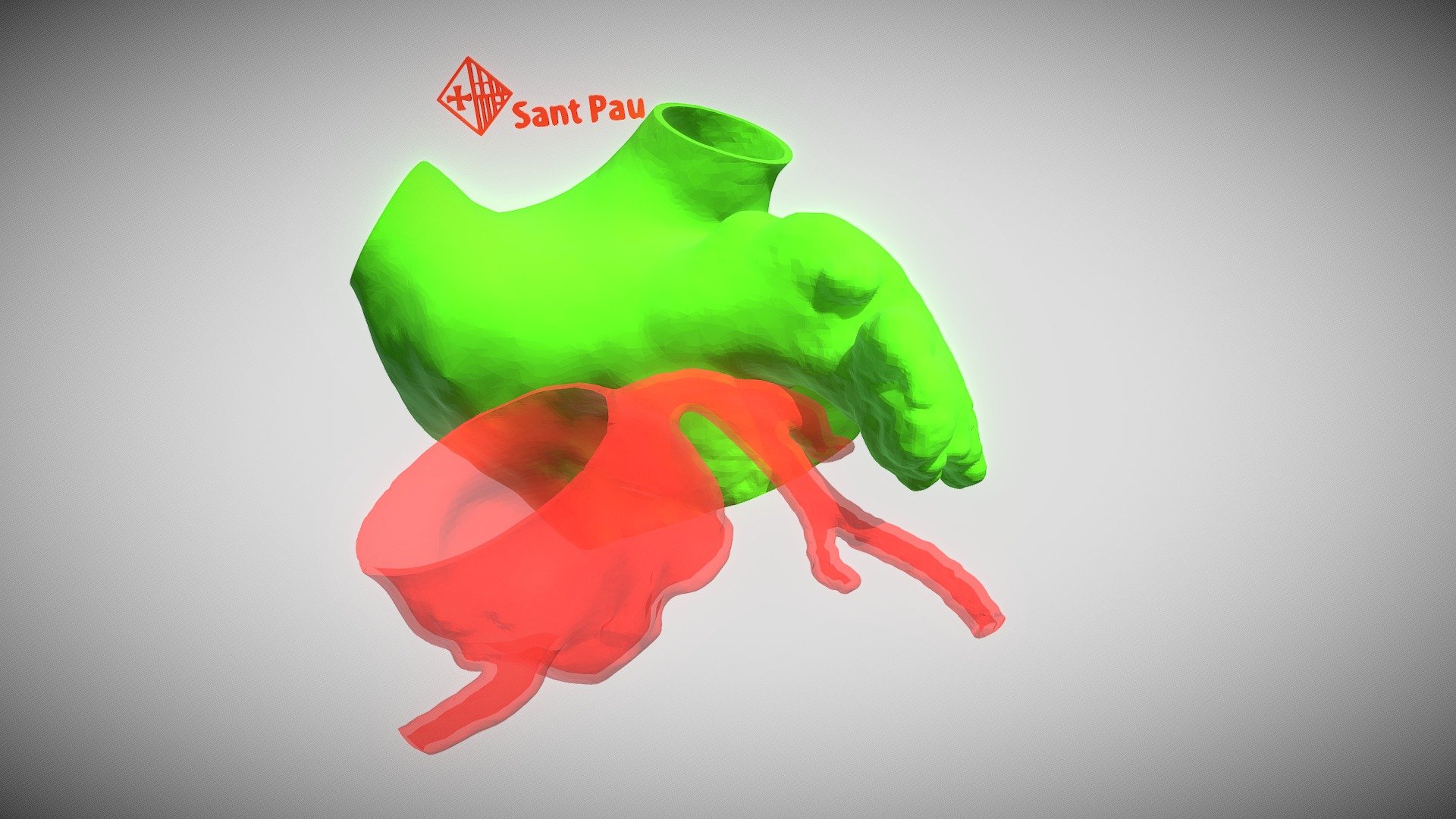 CSC2020: LAA occlusion planning - 3D model by Abdel Hakim Moustafa ...
