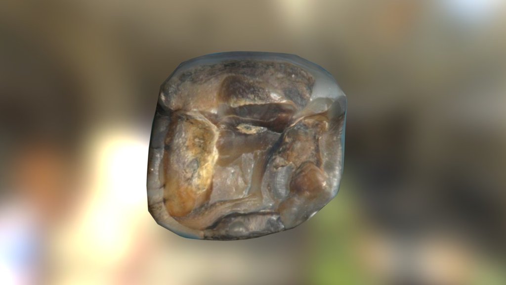 Crown Prep Scan - 3D model by Dr Kevin Ho (@khoster2016) [cf36767 ...